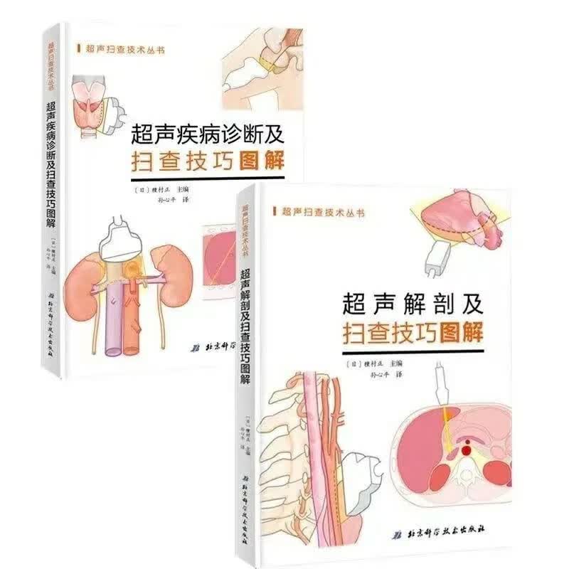 彩色印刷 2本 超声疾病诊断及扫查技巧图解+超声解剖及扫查技巧 超声解剖+超声疾病诊断（各一本）