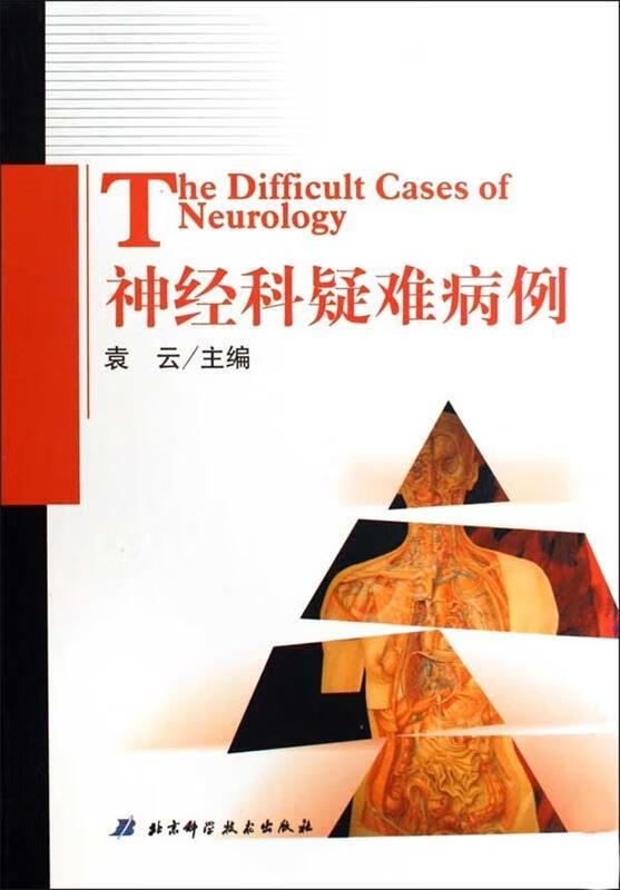 神经科疑难病例