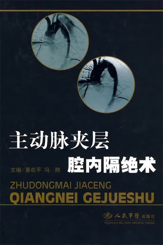 主动脉夹层腔内隔绝术【，放心购买】