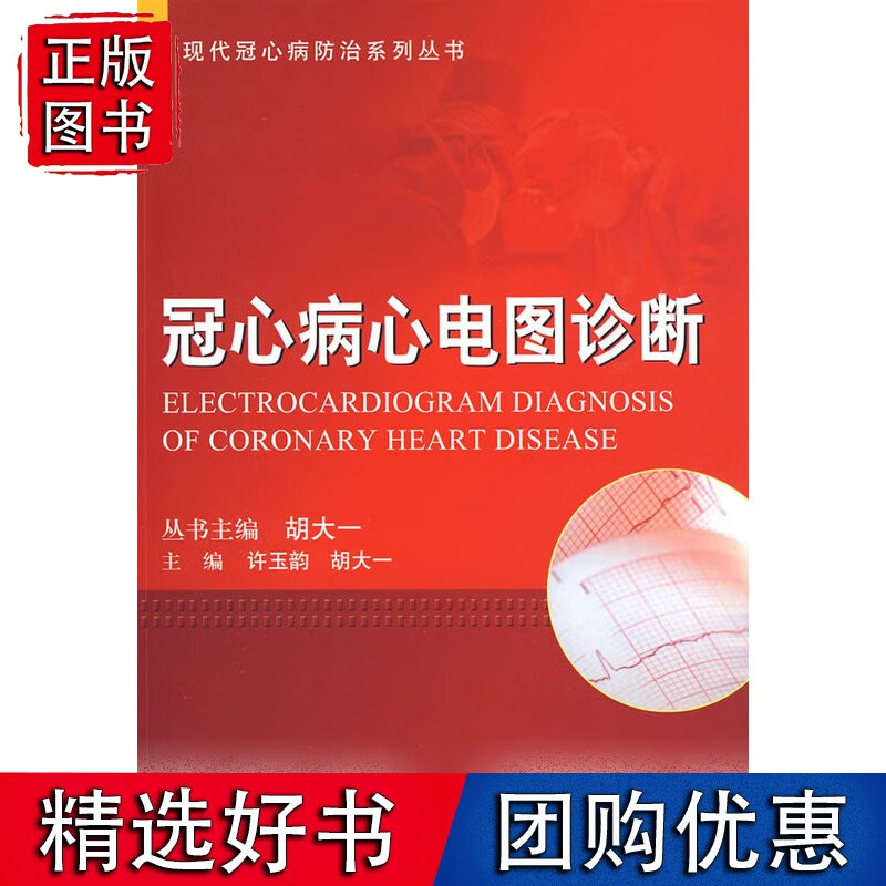 冠心病心电图诊断