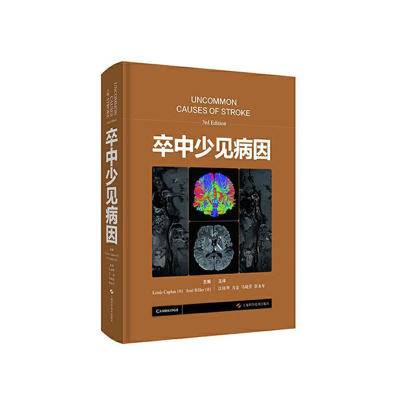 卒中少见病因医学 图书