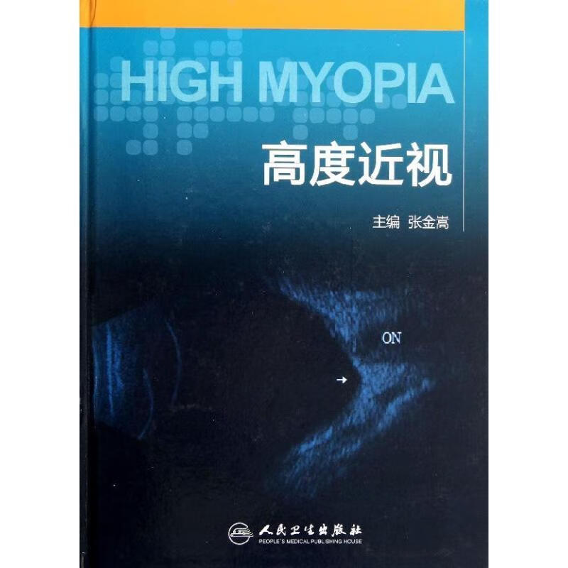 高度近视 张金嵩主编