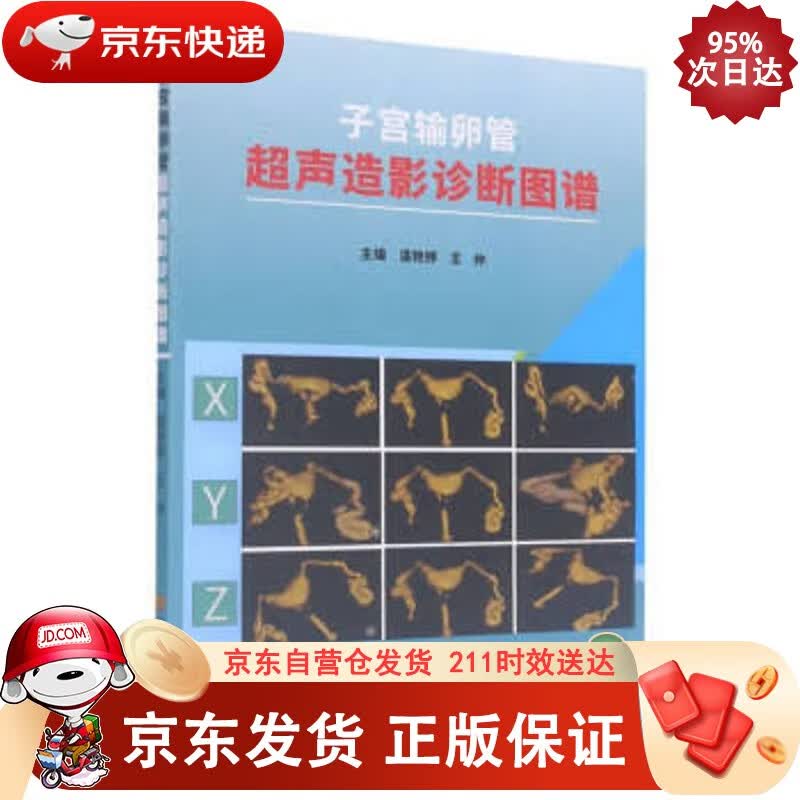 子宫输卵管超声造影诊断图谱