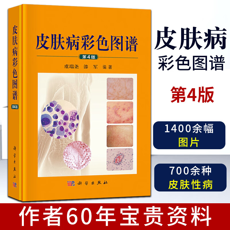 皮肤病彩色图谱 第4版 700余种皮肤性病科的常见病 多发病和一些少见病 疑难病 皮肤病学