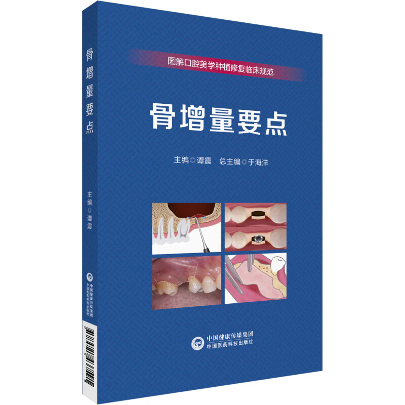 骨增量要点 谭震 编 书籍 图书