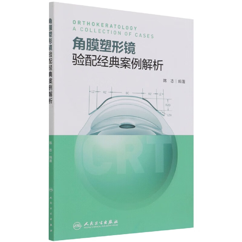 角膜塑形镜验配经典案例解析