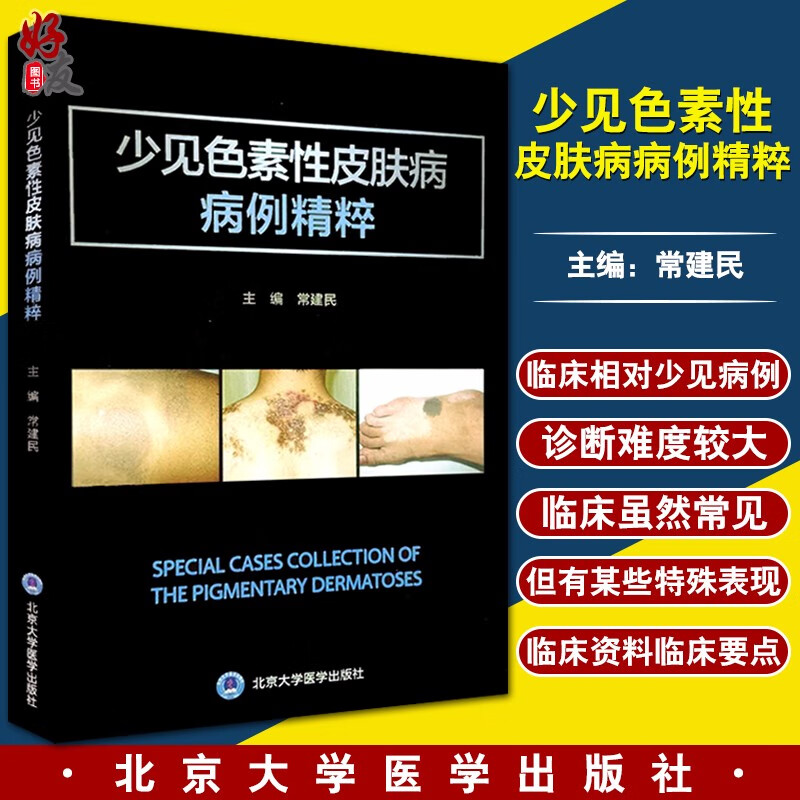少见色素性皮肤病病例精粹 常建民主编 北京大学医学出版社9787565922145皮肤病学