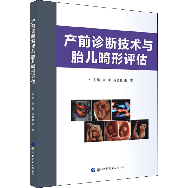 产前诊断技术与胎儿畸形评估
