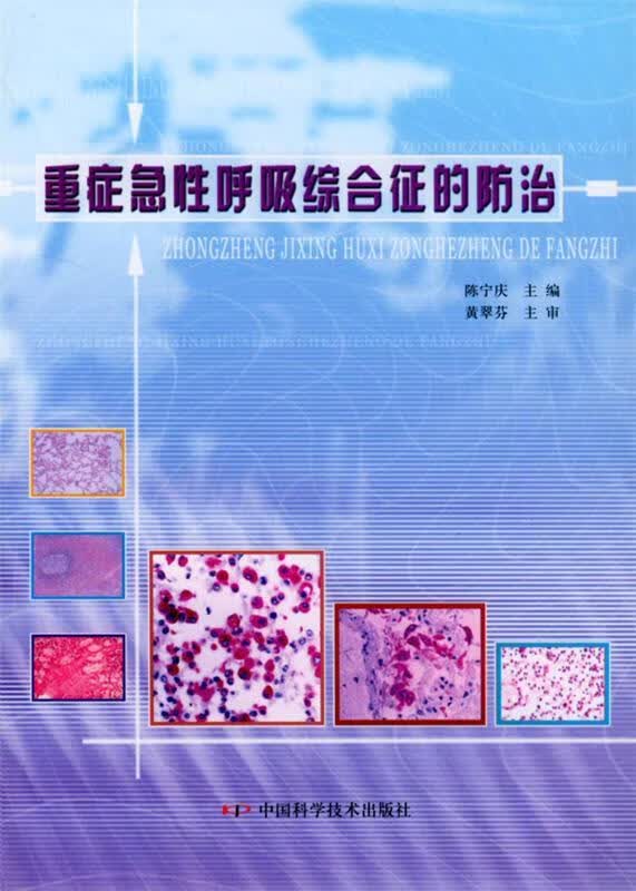 重症急性呼吸综合征的防治