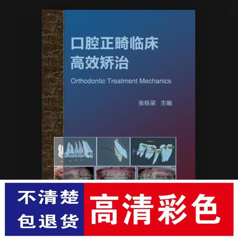 口腔正畸临床高效矫治