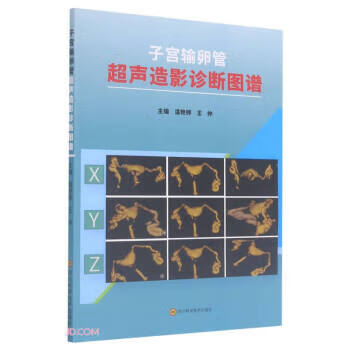 ！ 子宫输卵管超声造影诊断图谱 9787572701061 温艳婷,王仲 编 四川科学技术出版社