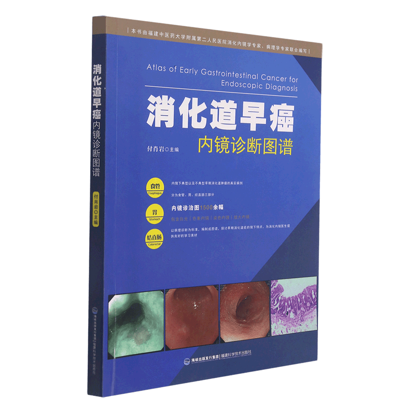 消化道早癌内镜诊断图谱