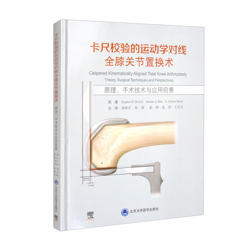 卡尺校验的运动学对线全膝关节置换术——原理、手术技术与应用前景
