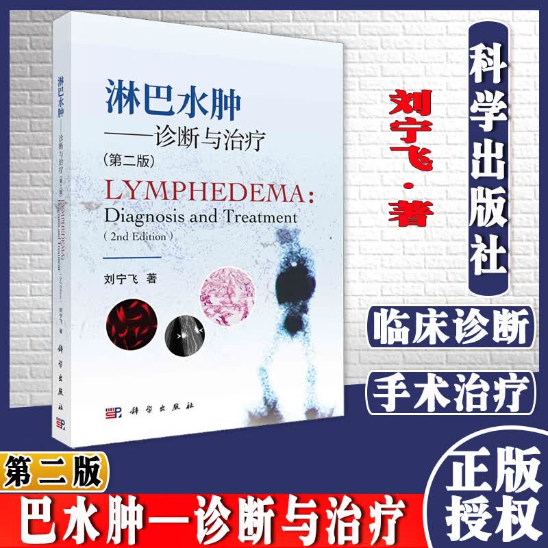 淋巴水肿 诊断与治疗 第二版 刘宁飞 著 淋巴水肿手法引流综合消肿治疗 淋巴水肿的分期 淋巴管瘤病 科学出版社 9787030697592