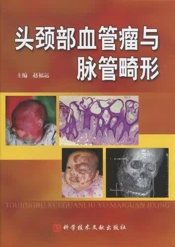 头颈部血管瘤与脉管畸形 赵福运 著【书】