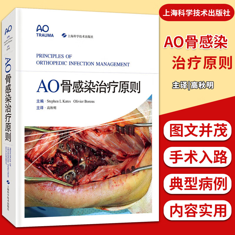 预售 AO骨感染治疗原则 上海科学技术出版社