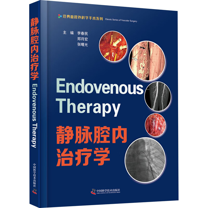 静脉腔内治疗学