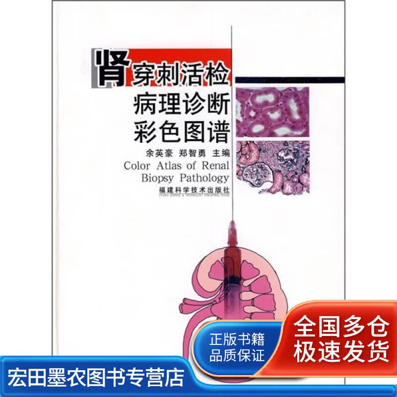 肾穿刺活检病理诊断彩色图谱【好书】
