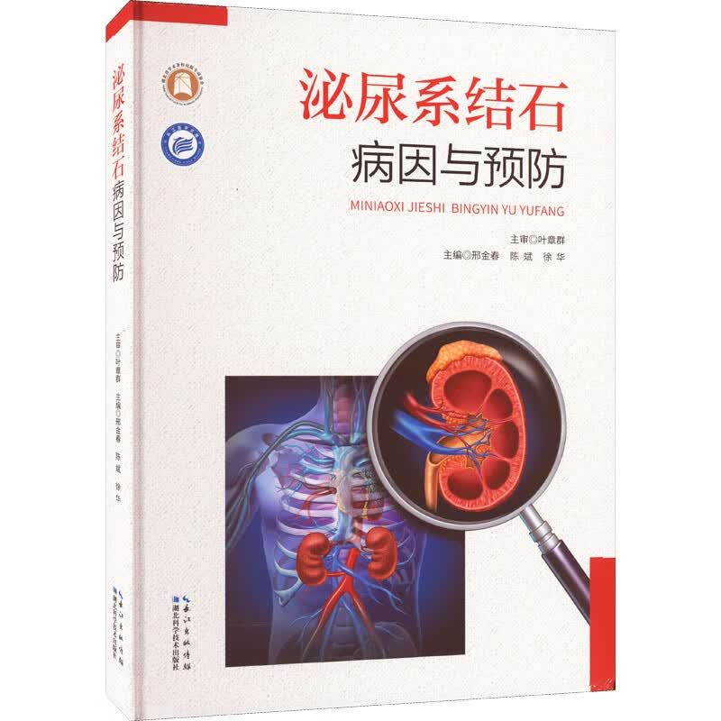 泌尿系结石病因与预防