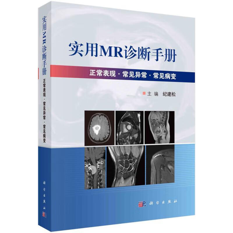 超清印制实用MR诊断手册