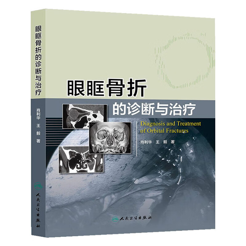 【现货】眼眶骨折的诊断与治疗