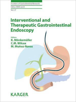 高被引Interventional and Therapeutic Gastrointesti