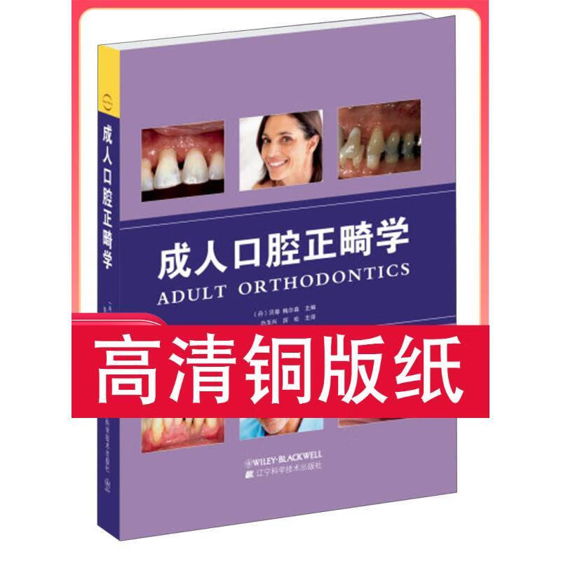 口腔正畸学 110克激光纸