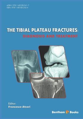 The Tibial Plateau Fractures: : Diagnosis and T