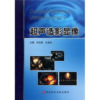 超声造影显像