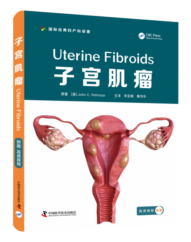 子宫肌瘤