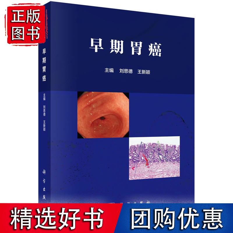 早期胃癌