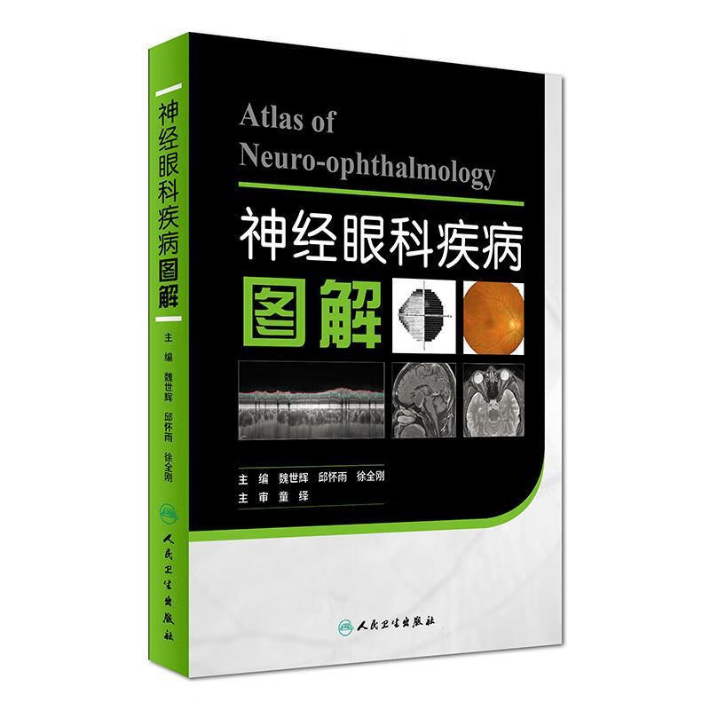 神经眼科疾病图解(精)