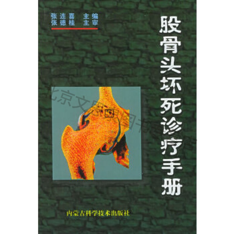 股骨头坏死诊疗手册