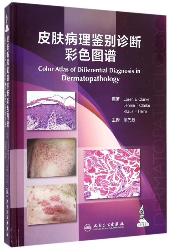 皮肤病理鉴别诊断彩色图谱(精)