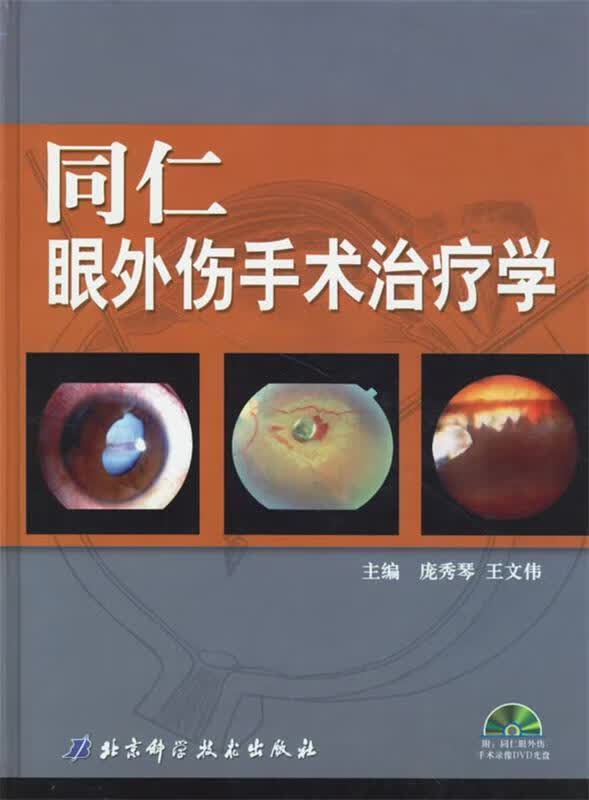 同仁眼外手术治疗学