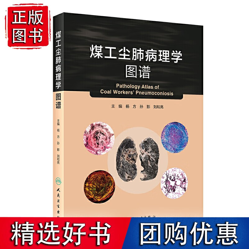 煤工尘肺病理学图谱