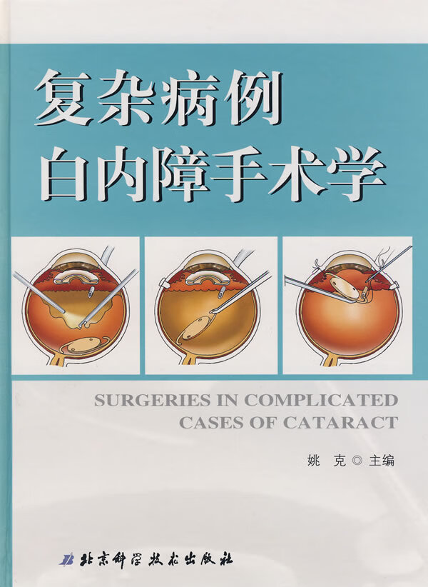 复杂病例白内障手术学 姚克 主编【书】