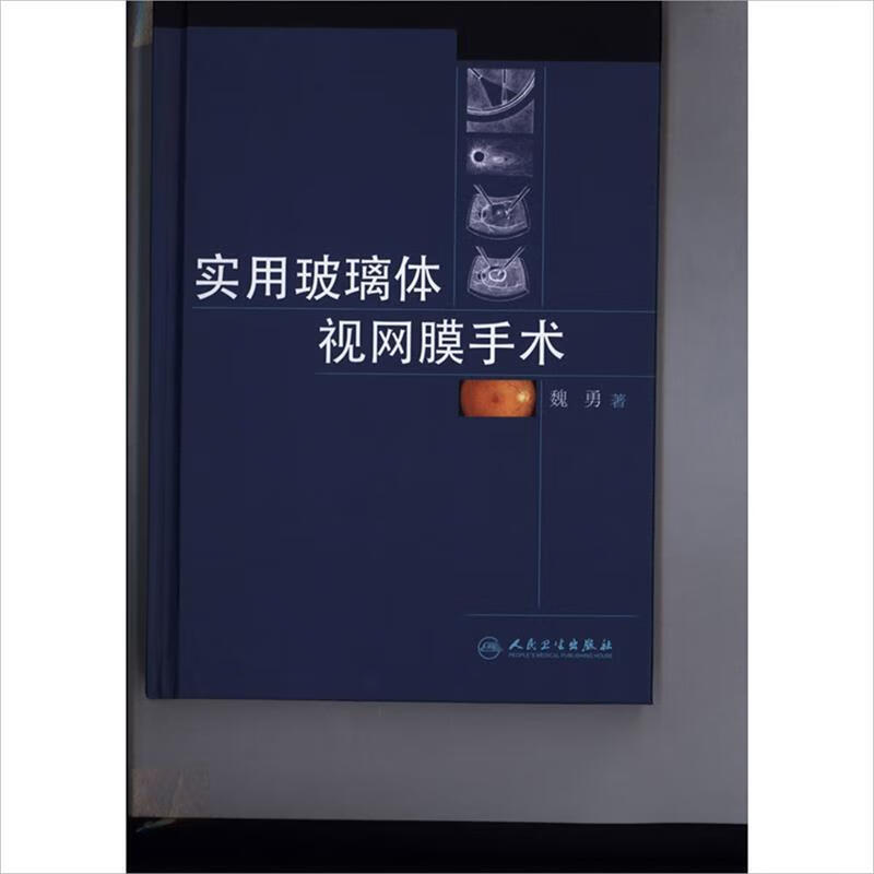 实用玻璃体视网膜手术