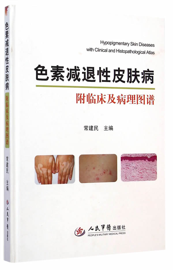 色素减退性皮肤病-附临床及病理图谱
