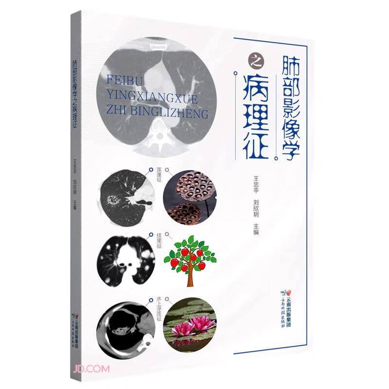 肺部影像学之病理征