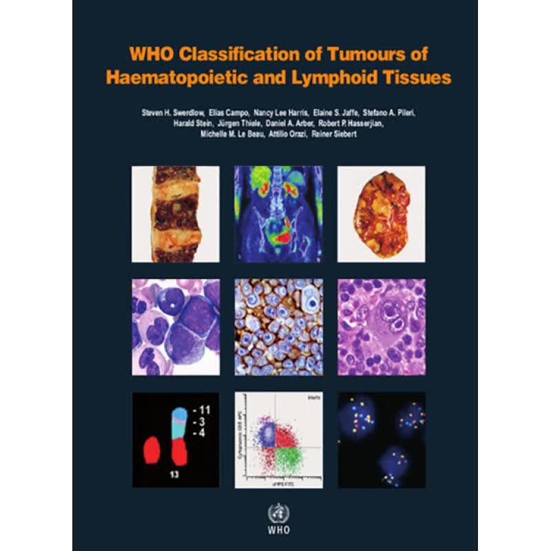 现货 世界卫生组织造血和淋巴组织肿瘤分类 WHO classification of tumo...