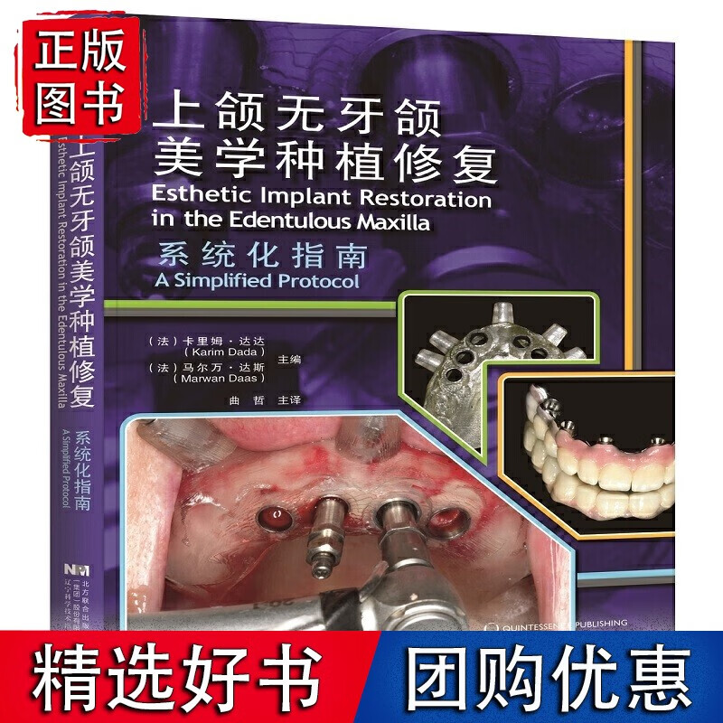 上颌无牙颌美学种植修复系统化指南
