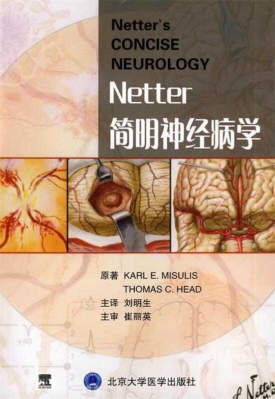 简明学:NEDTTER'S CONCISE NEUROLOGY NETTER