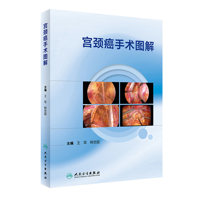 宫颈癌手术图解 附手术视频 王军 全部宫颈癌的手术类型 妇产科宫颈癌手术临床解剖实践案例 人民