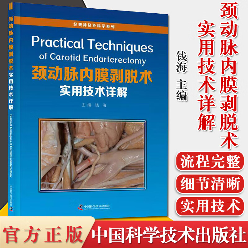 颈动脉内膜剥脱术实用技术详解 流程完整细节清晰实战经验初学优选 钱海主编神经外科及血