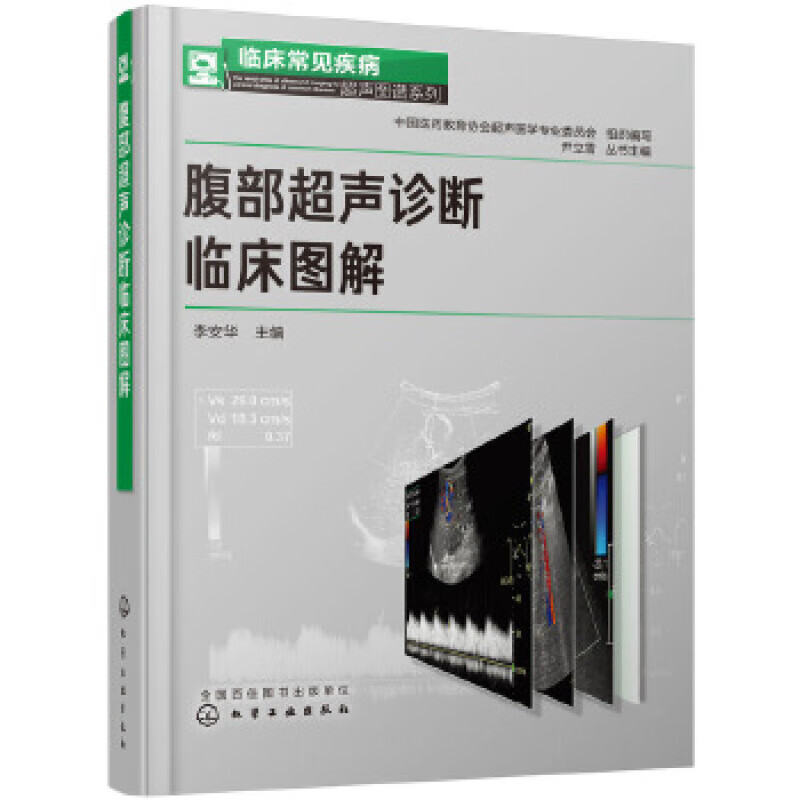 腹部超声诊断临床图解 李安华 主编 9787122348357 化学工业出版社