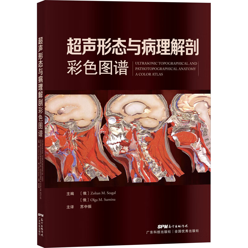 超声形态与病理解剖彩色图谱