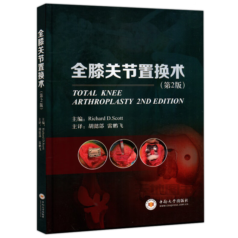 全膝关节置换术(第二版)第2版 TOTAL KNEE ARTHROPLASTY 2ND EDITI