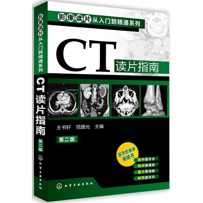 CT读片指南(第二版) 影像读片从入门到精通系列