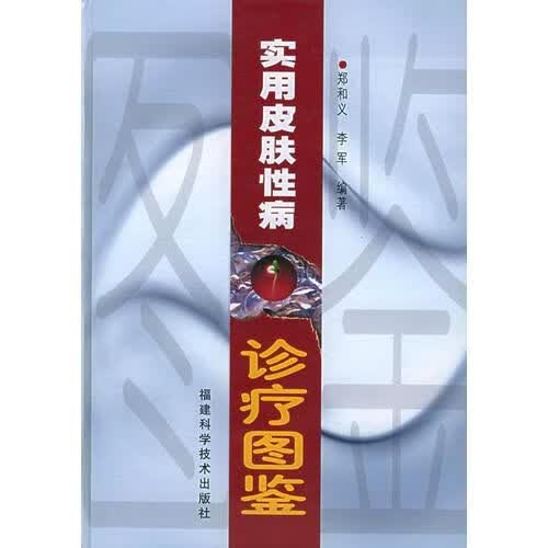 实用皮肤性病诊疗图鉴精装